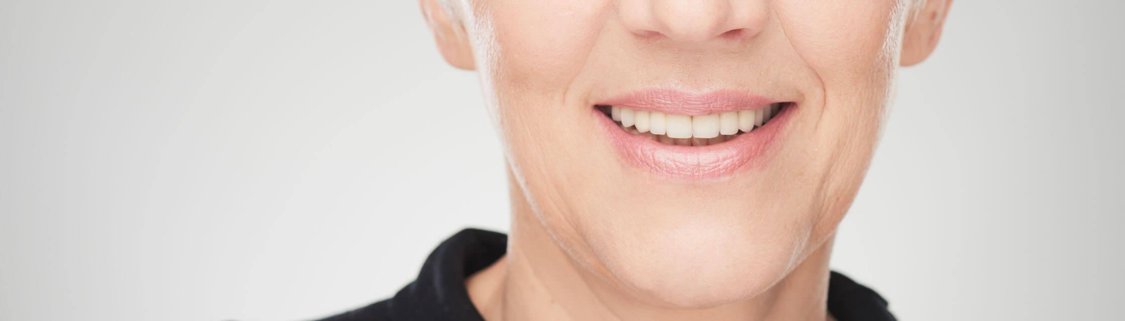 Faltenbehandlung bei Kinnfalten, Kinnfurche, "Pflasterstein" Kinn mit ...